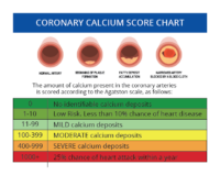 CALCIUM SCORE, IL TEST PER LA PREVENZIONE DEL RISCHIO CARDIOVASCOLARE ...