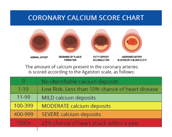 CALCIUM SCORE, IL TEST PER LA PREVENZIONE DEL RISCHIO CARDIOVASCOLARE ...