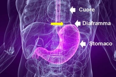 LA SINDROME GASTRO-CARDIACA, QUANDO LA TACHICARDIA NON DIPENDE DAL ...